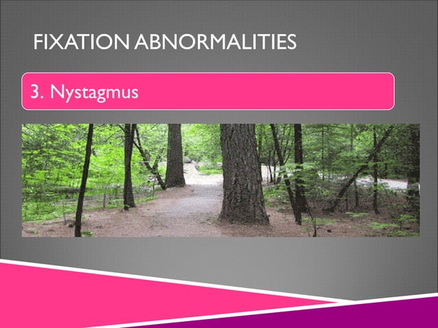 Fixation Characteristics And Abnormalities Ppt Computer Animation