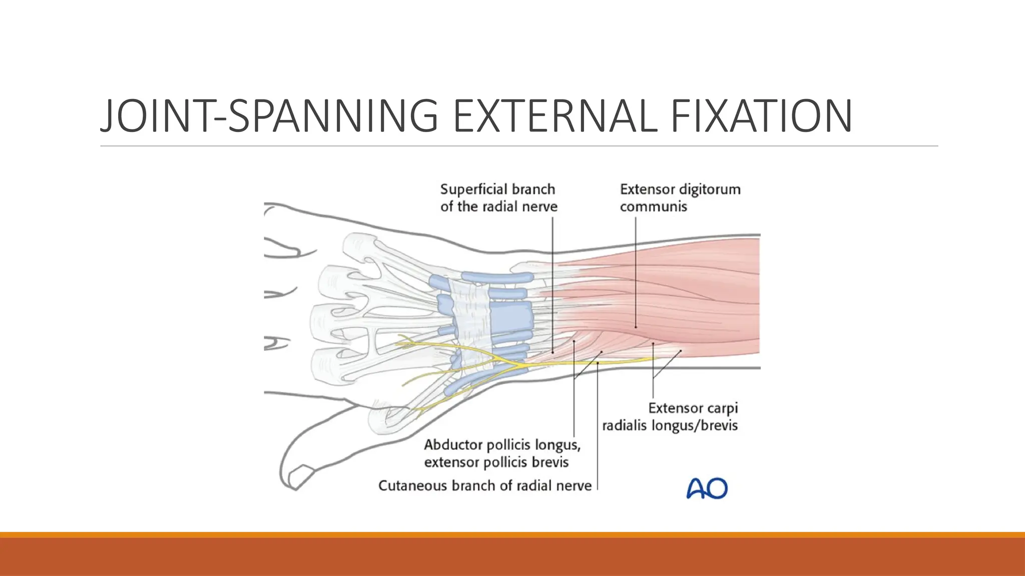 Fixation Methods and Implants for Distal Radius Fractures & Post-Op ...