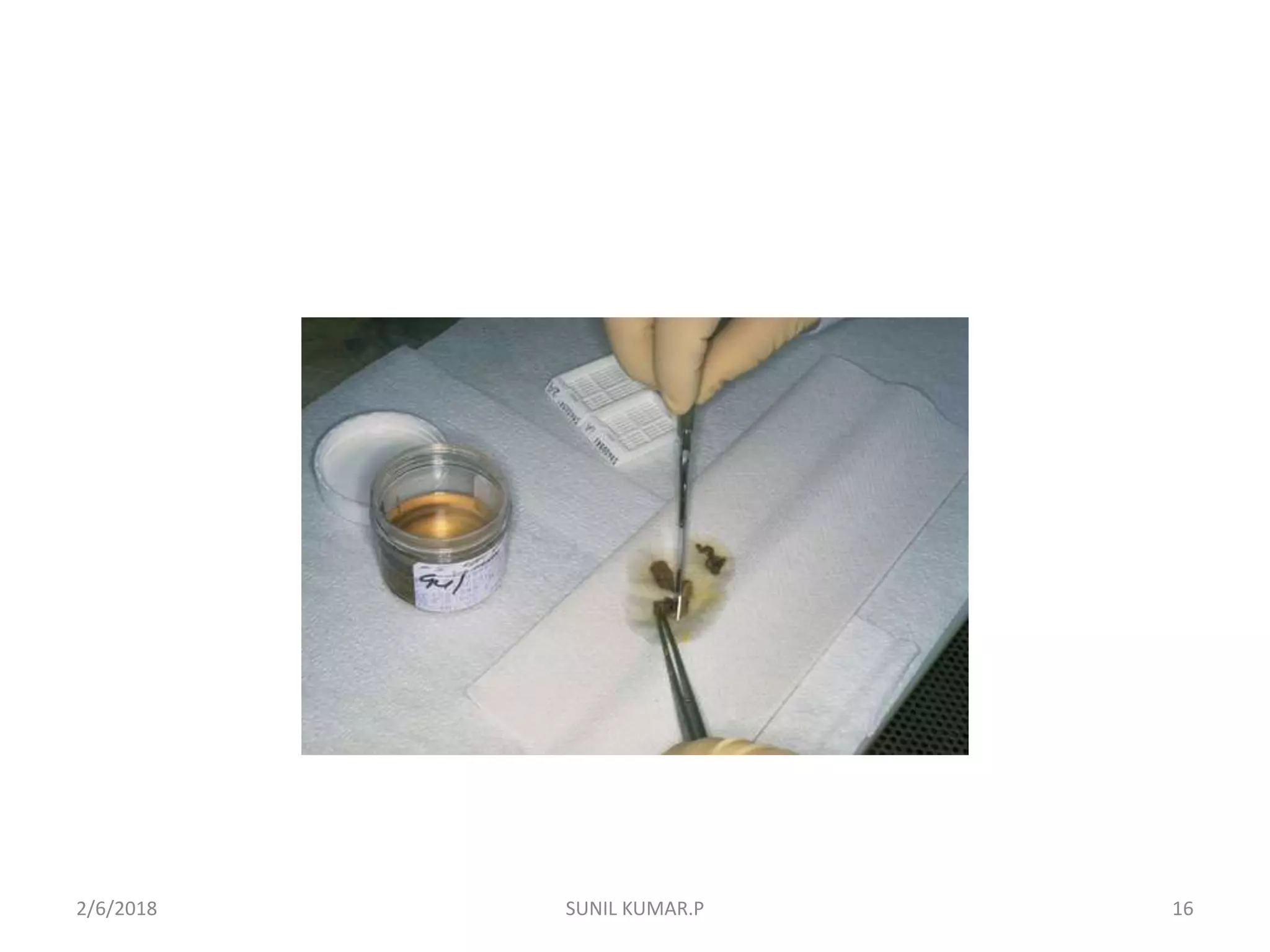 Fixation of tissues | PPTX