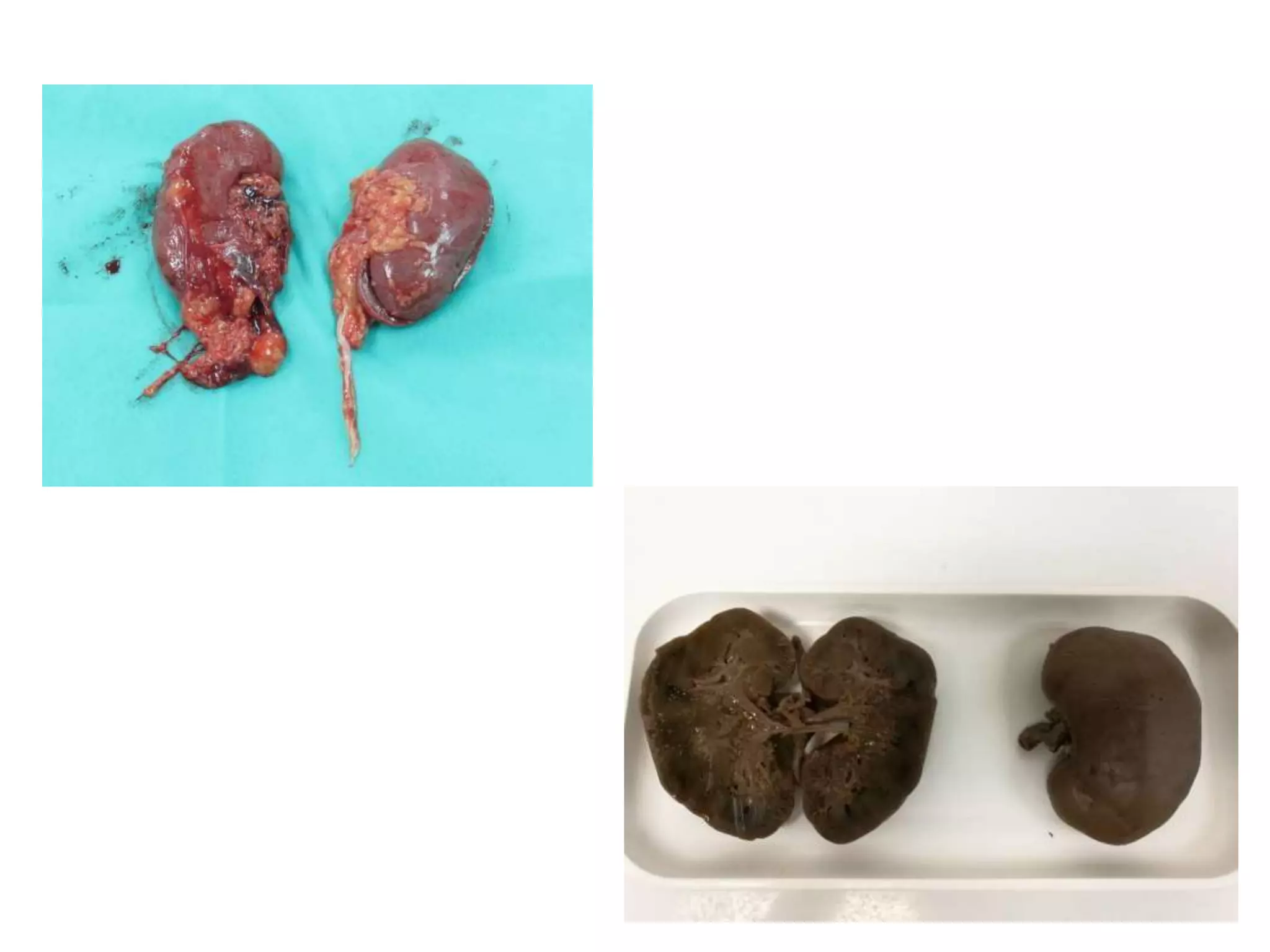 Histological Techniques: Section 2:Fixation of tissues | PPTX