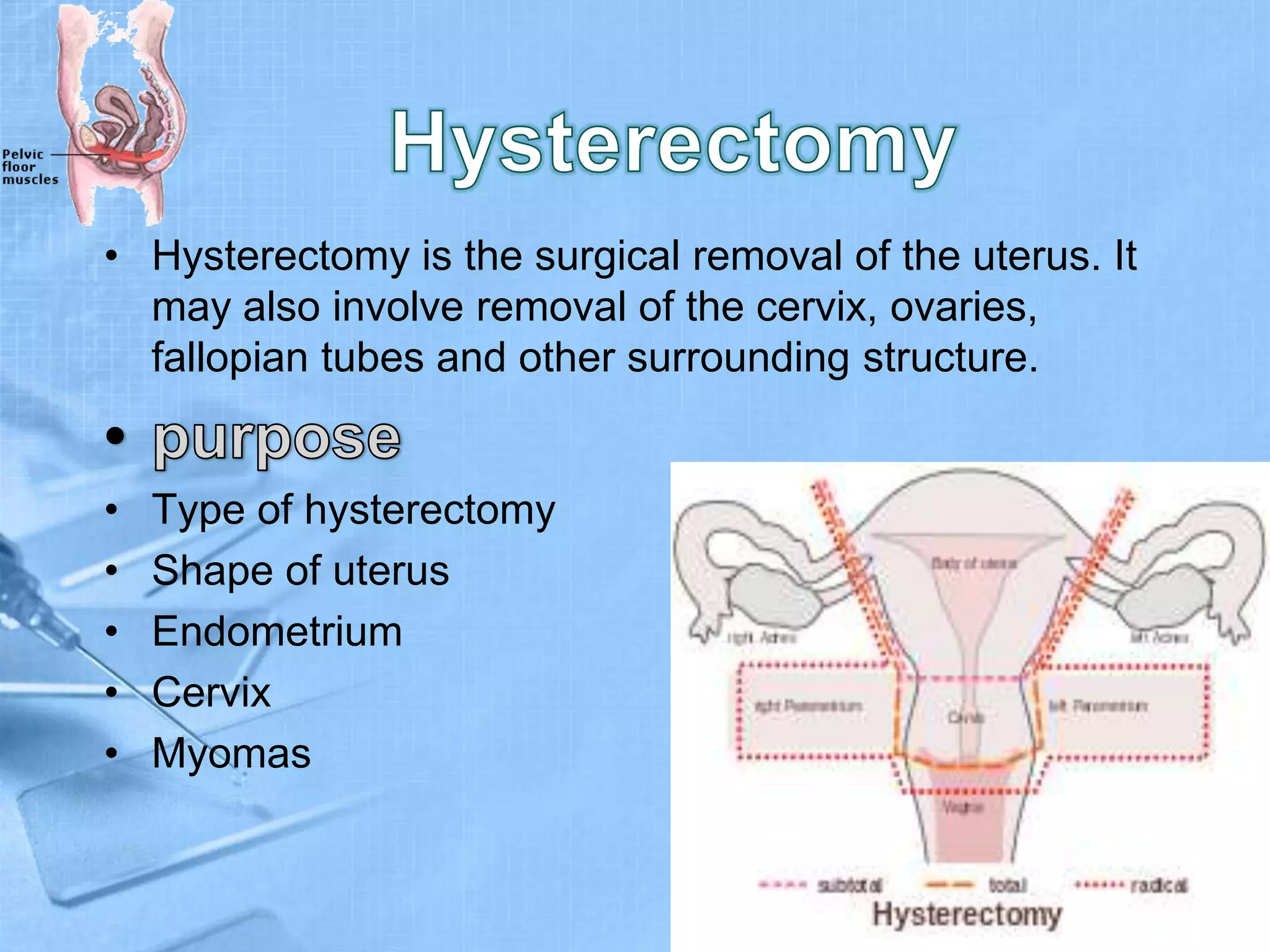 Fixation of uterus after whole hysterectomy | PPTX