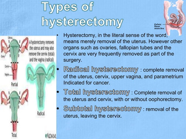 Fixation of uterus after whole hysterectomy | PPT