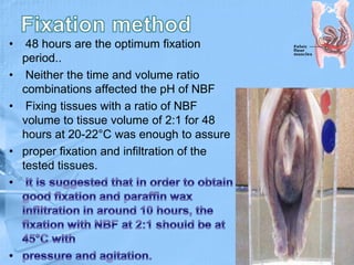 Fixation of uterus after whole hysterectomy | PPTX