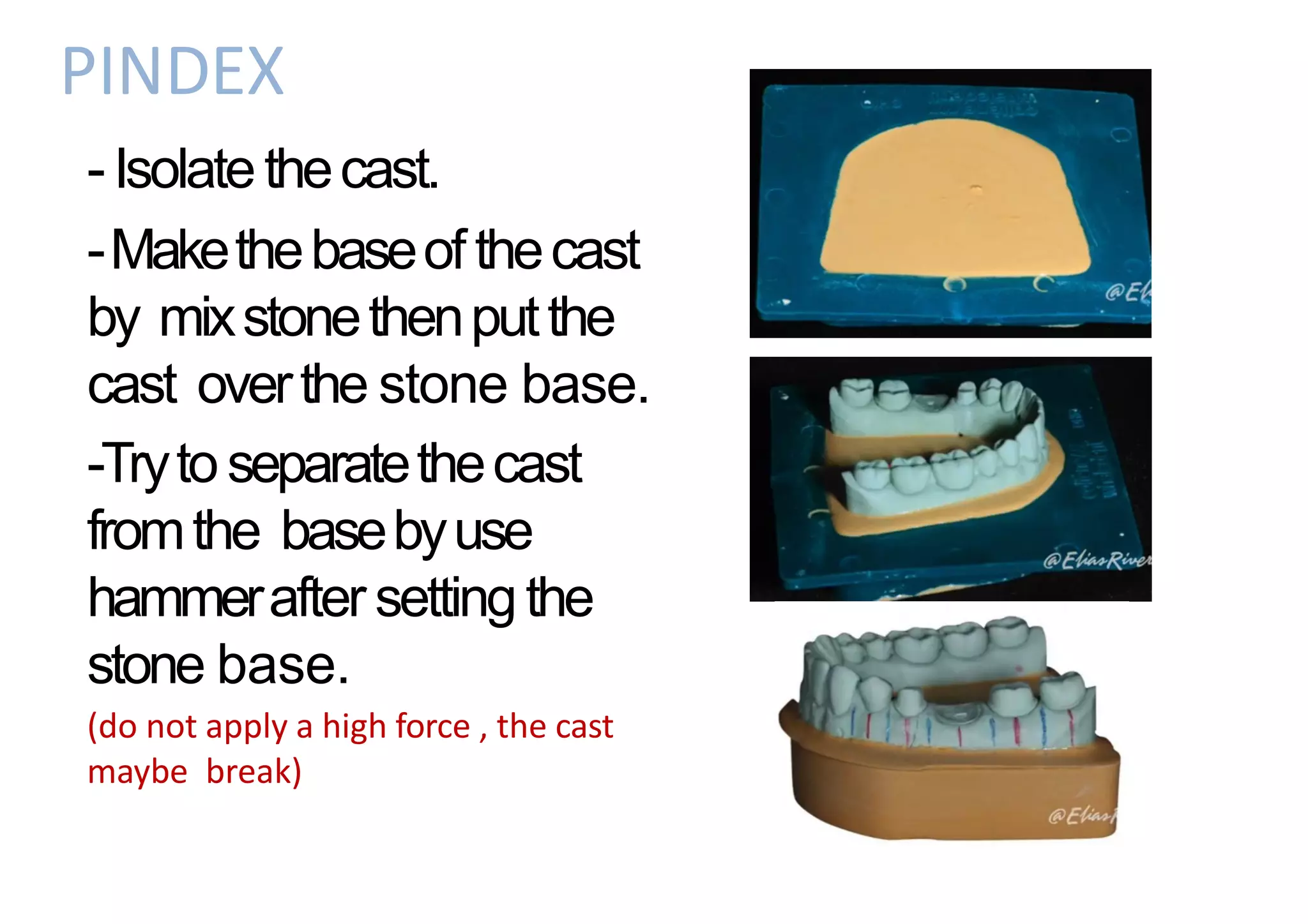 cast and die preparation in fixed prosthodontics | PDF
