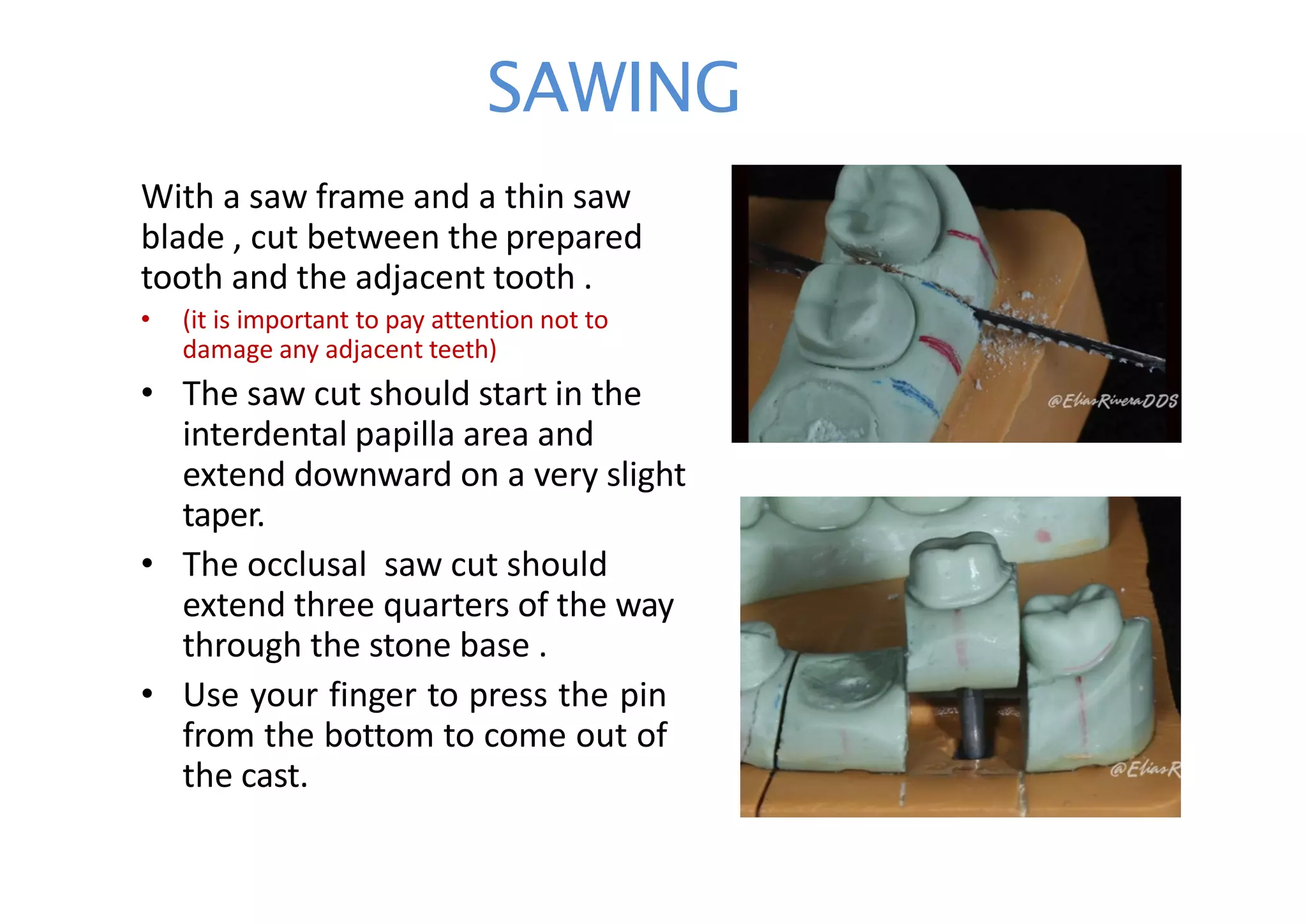 cast and die preparation in fixed prosthodontics | PDF
