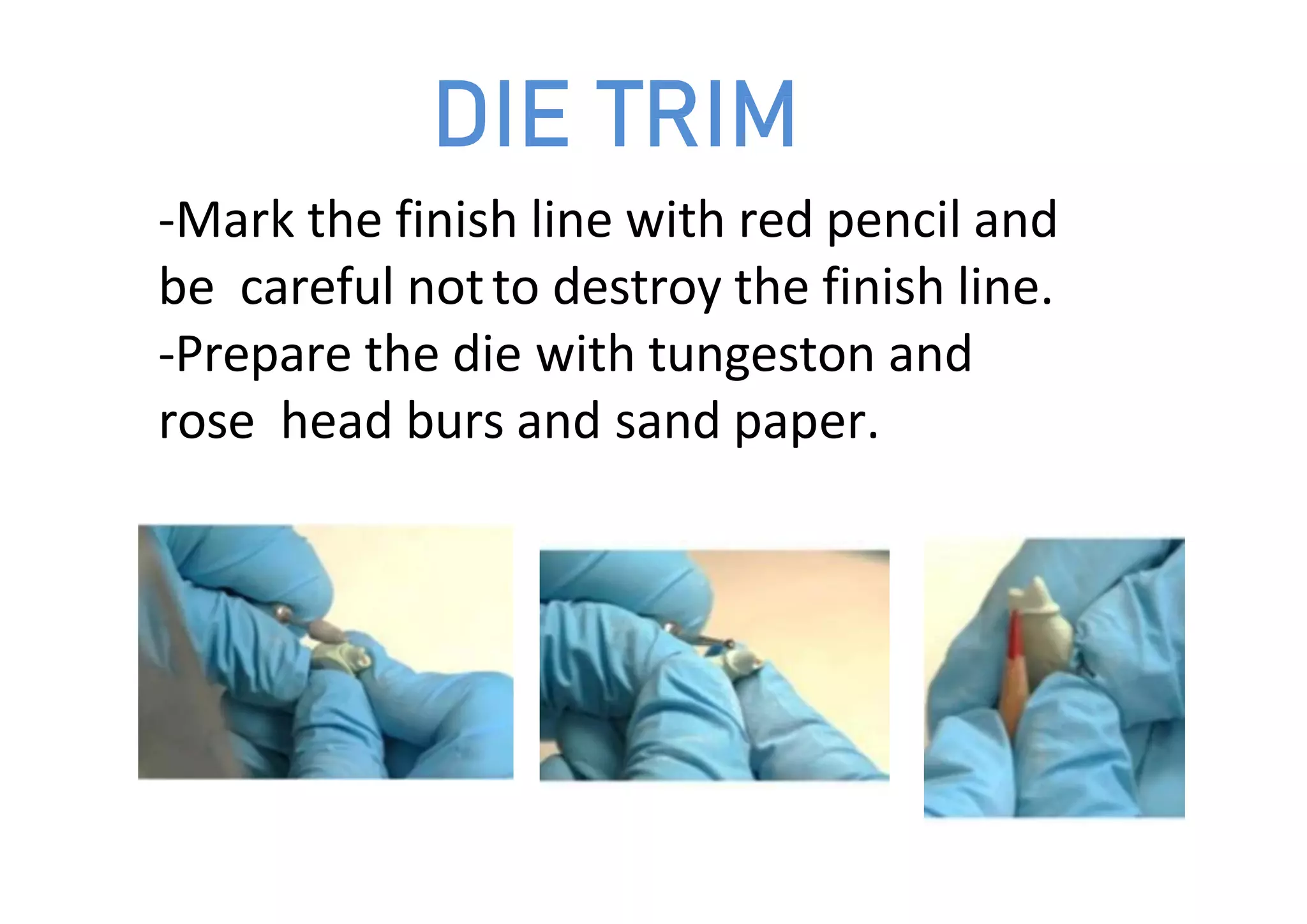 cast and die preparation in fixed prosthodontics | PDF
