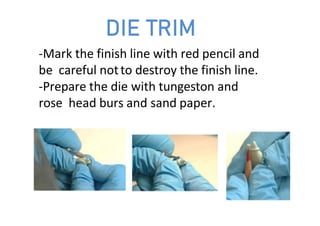 cast and die preparation in fixed prosthodontics | PDF