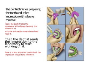cast and die preparation in fixed prosthodontics | PDF