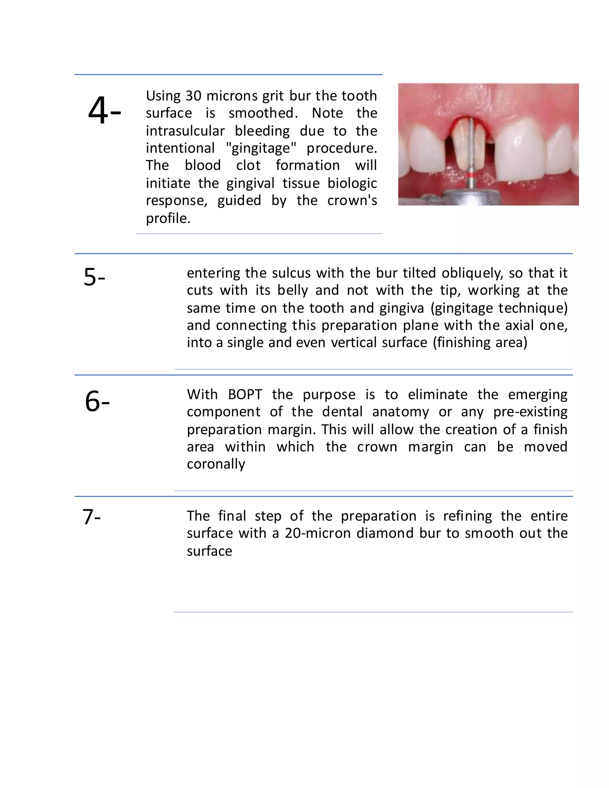 BIOLOGICALLY ORIENTED PREPARATION TECHNIQUE (BOPT) | DOCX