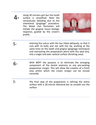 BIOLOGICALLY ORIENTED PREPARATION TECHNIQUE (BOPT) | DOCX
