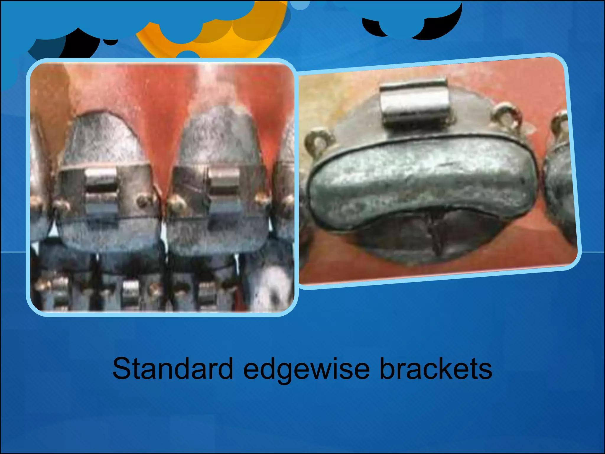 Fixed orthodontic appliances | PPTX