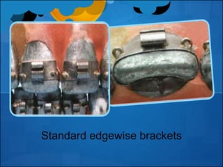 Fixed orthodontic appliances | PPTX