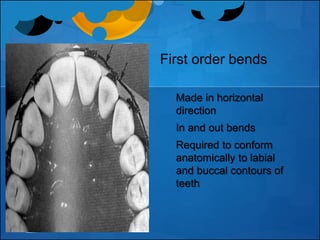 Fixed orthodontic appliances | PPTX