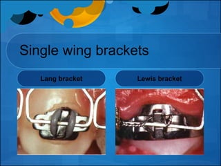 Fixed orthodontic appliances | PPTX