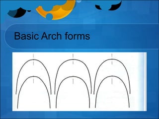 Fixed orthodontic appliances | PPTX