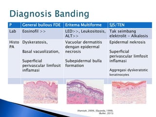 Fixed drug eruption x hipersensitivitas | PPTX
