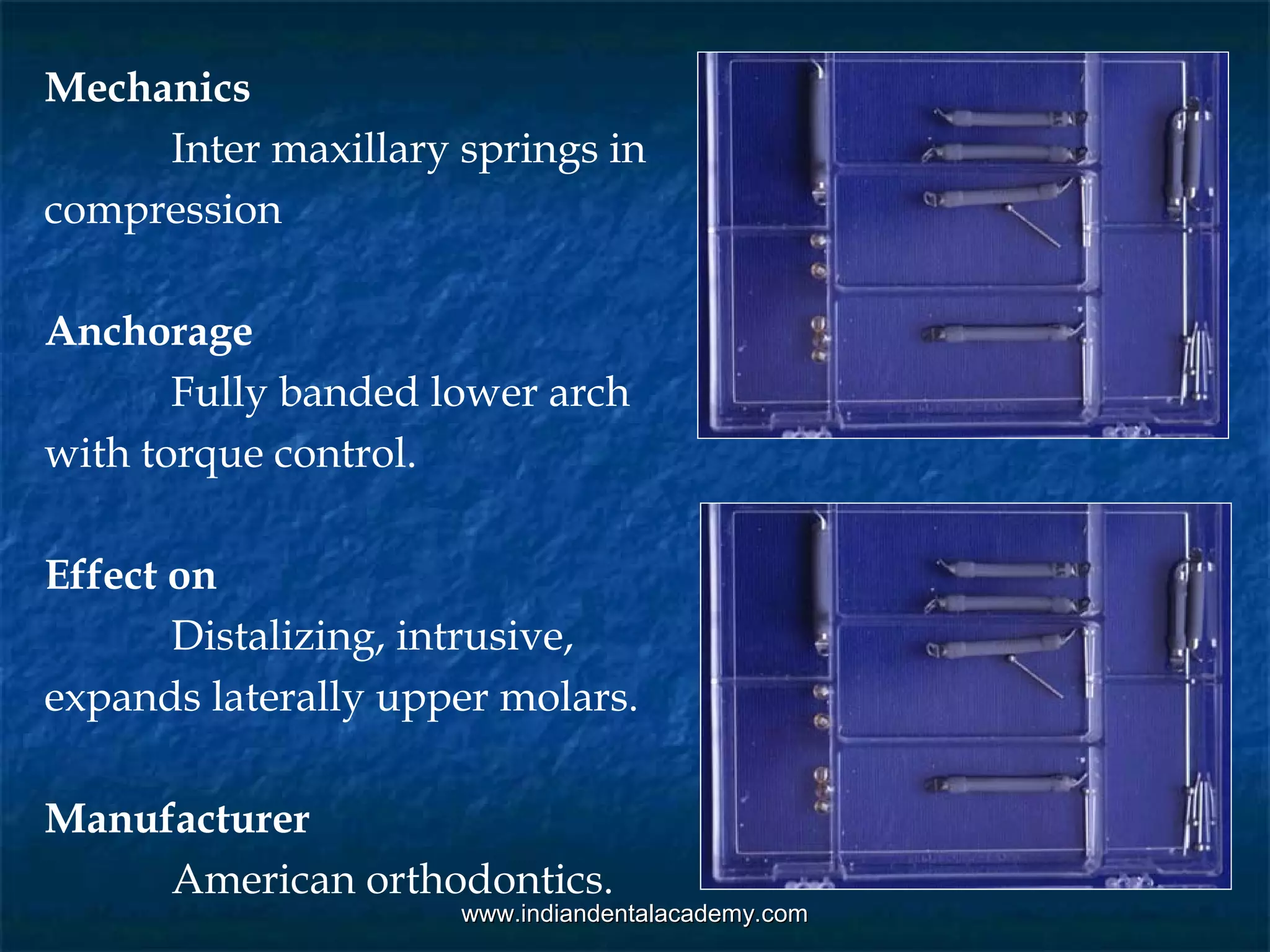 Fixed functional appliance | PPT