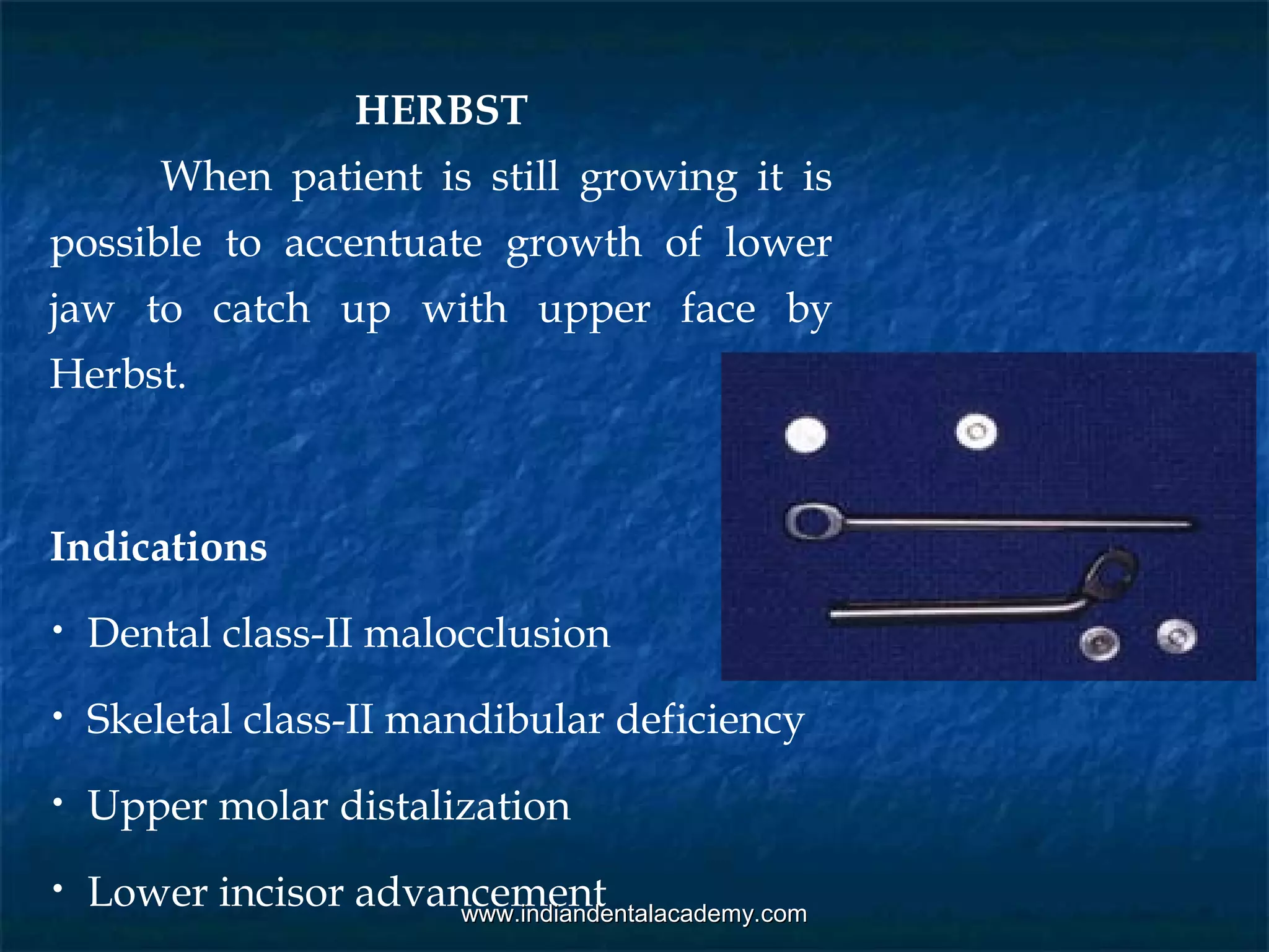 Fixed functional appliance | PPT