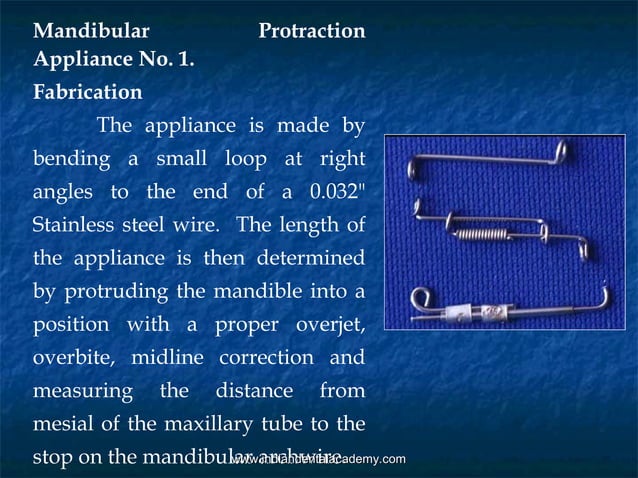 Fixed functional appliance | PPT