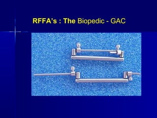 Fixed functional appliances | PPT