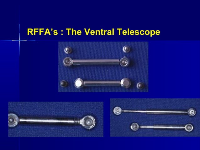 Fixed functional appliances | PPT | Home Appliances | Home & Garden