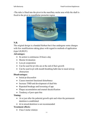 fixed functional appliances.pdf