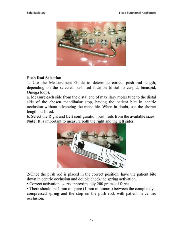 fixed functional appliances.pdf