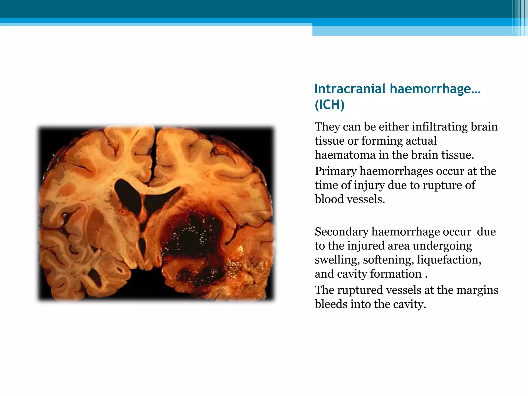 Head injuries in forensic medicine | PPS