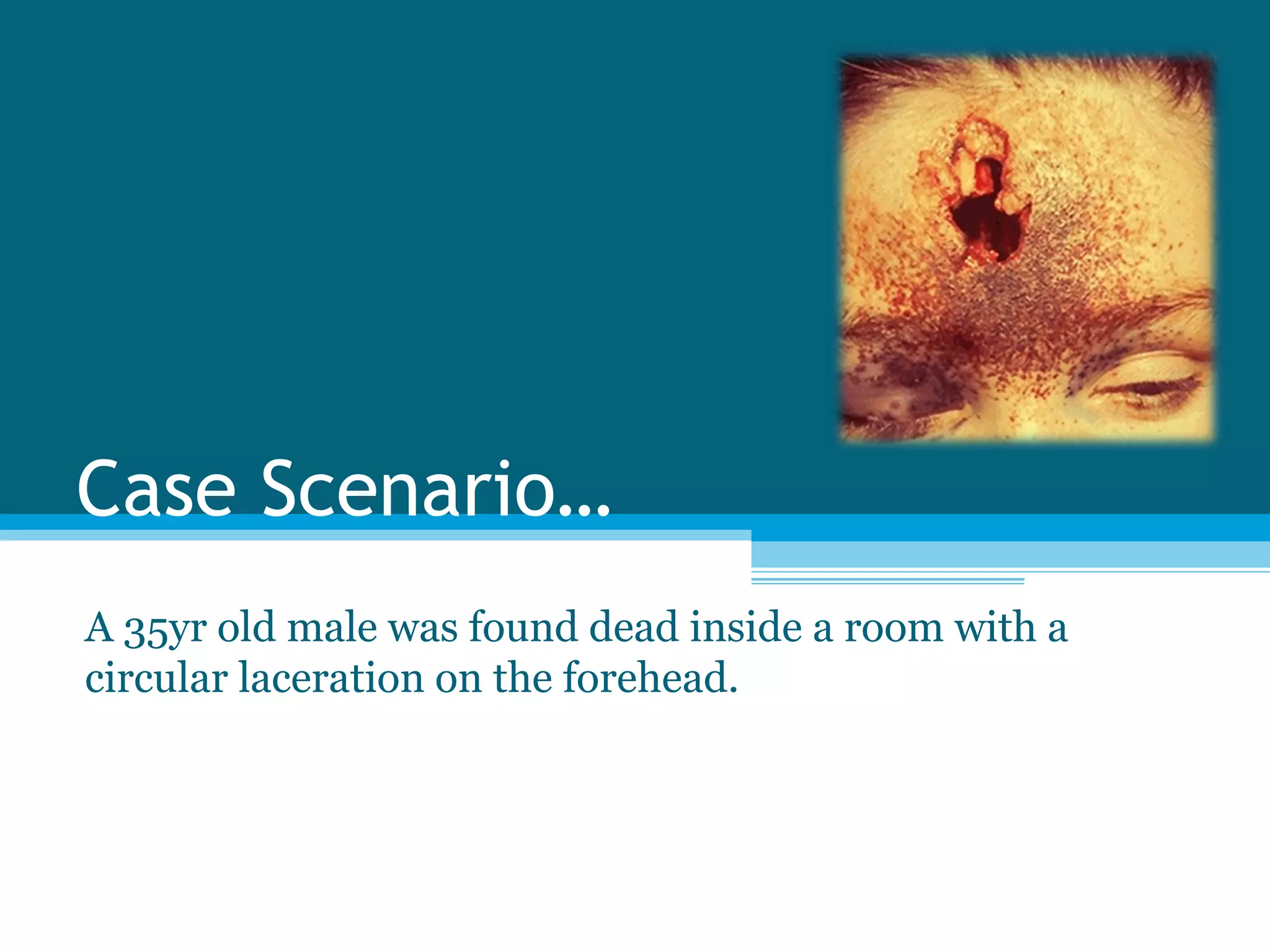 Head injuries in forensic medicine | PPS