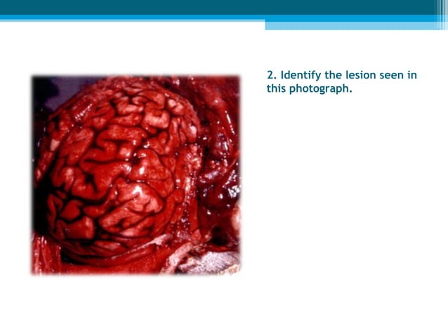Head injuries in forensic medicine | PPS