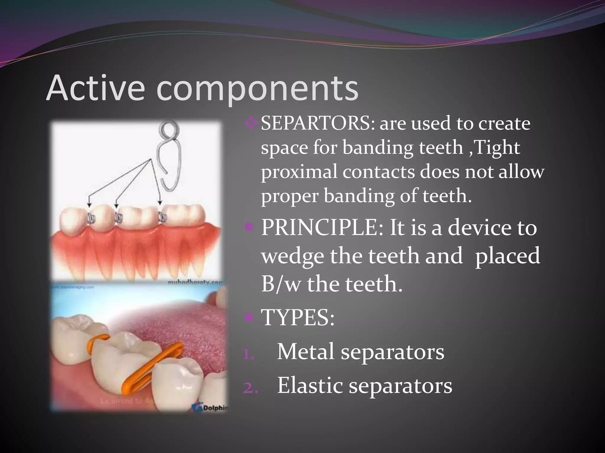 Fixed orthodontic appliances by khaled sadeq | PPTX