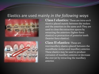 Fixed orthodontic appliances by khaled sadeq | PPTX