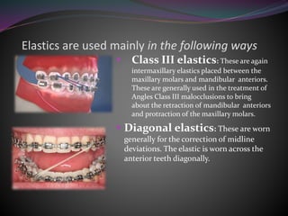 Fixed orthodontic appliances by khaled sadeq | PPTX