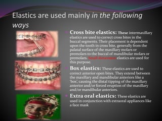 Fixed orthodontic appliances by khaled sadeq | PPTX