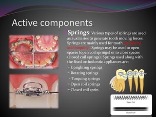 Fixed orthodontic appliances by khaled sadeq | PPTX