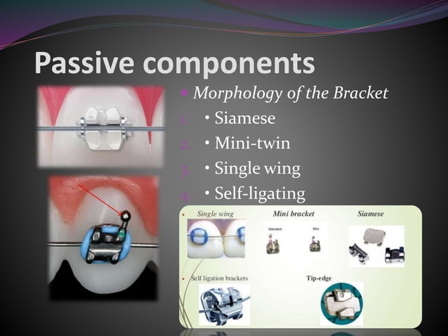 Fixed orthodontic appliances by khaled sadeq | PPT