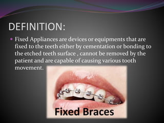 Fixed orthodontic appliances by khaled sadeq | PPTX