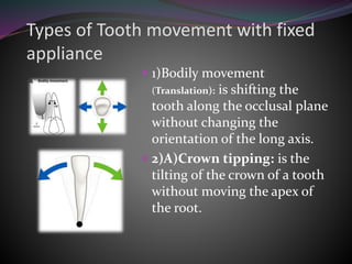 Fixed orthodontic appliances by khaled sadeq | PPTX