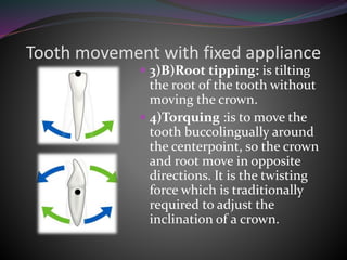 Fixed orthodontic appliances by khaled sadeq | PPTX
