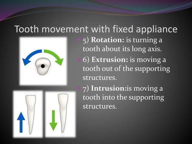 Fixed orthodontic appliances by khaled sadeq | PPT