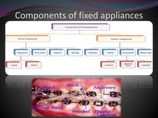 Fixed orthodontic appliances by khaled sadeq | PPTX