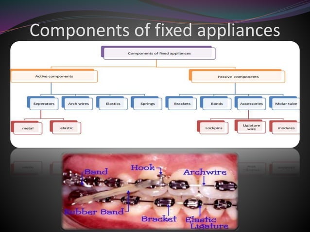 Fixed orthodontic appliances by khaled sadeq | PPT