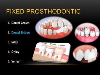 Fixed prosthodontic | PPSX