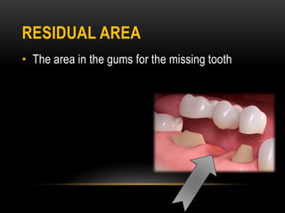 Fixed prosthodontic | PPSX