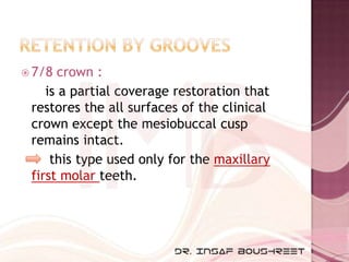 Fixed prosthodontics lesson 4 | PPSX
