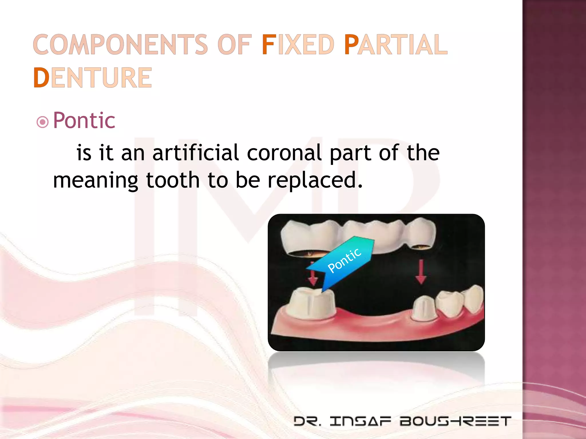 Fixed prosthodontics lesson 5 | PPSX