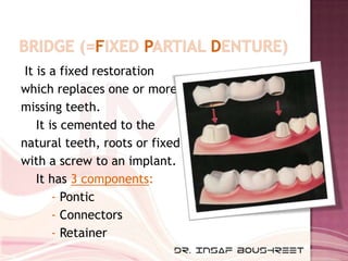 Fixed prosthodontics lesson 5 | PPSX