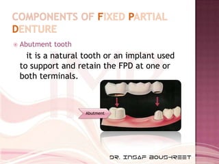 Fixed prosthodontics lesson 5 | PPSX