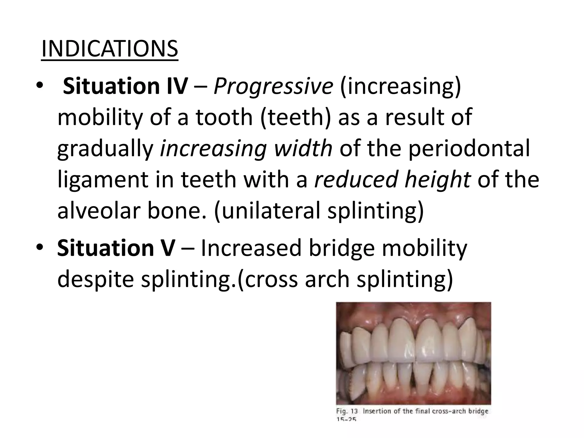 Fixed prosthodontics with periodontally compromised dentition | PPTX