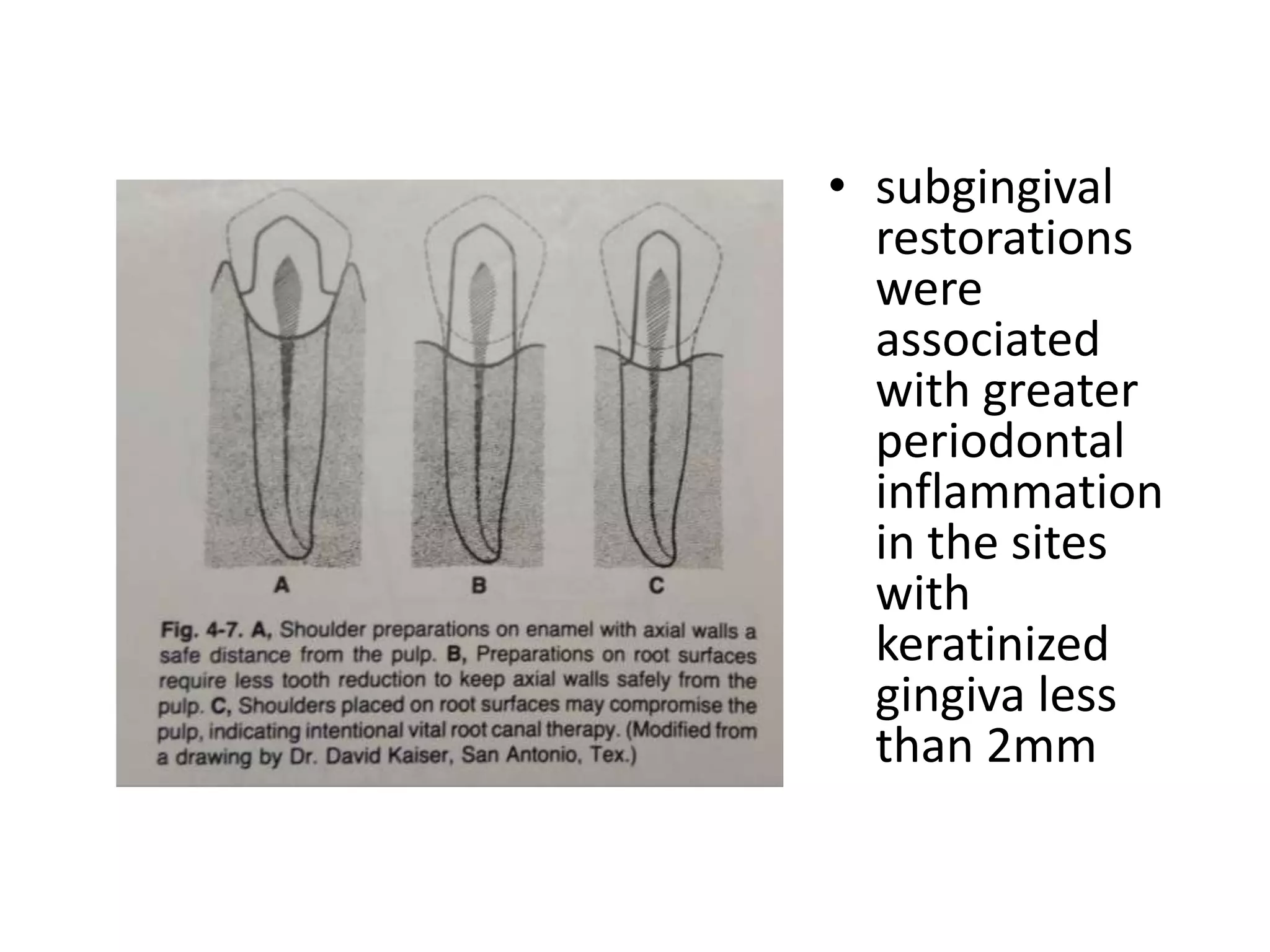 Fixed prosthodontics with periodontally compromised dentition | PPTX